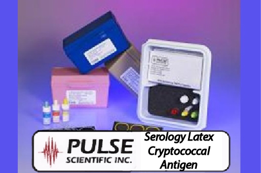 IN FUNG Co., Ltd - Product - Cryptococcal Antigen Antibody Latex Test